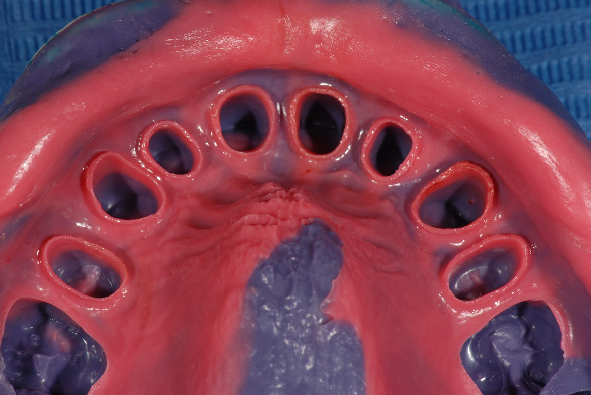 Dental News - New paradigm in aesthetic restoration