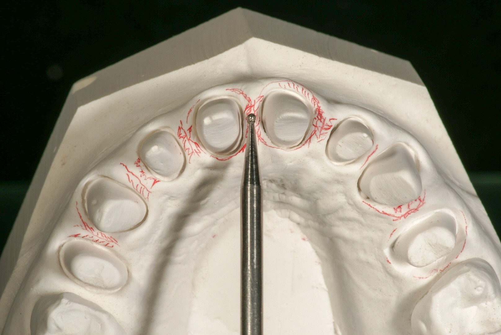 Dental News - New paradigm in aesthetic restoration