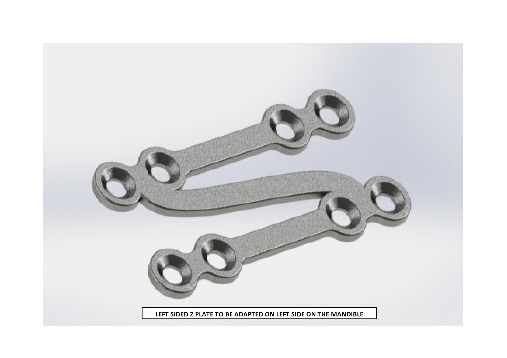 DT News - India - "Z-plate for mandibular fractures"- Design patent for ...