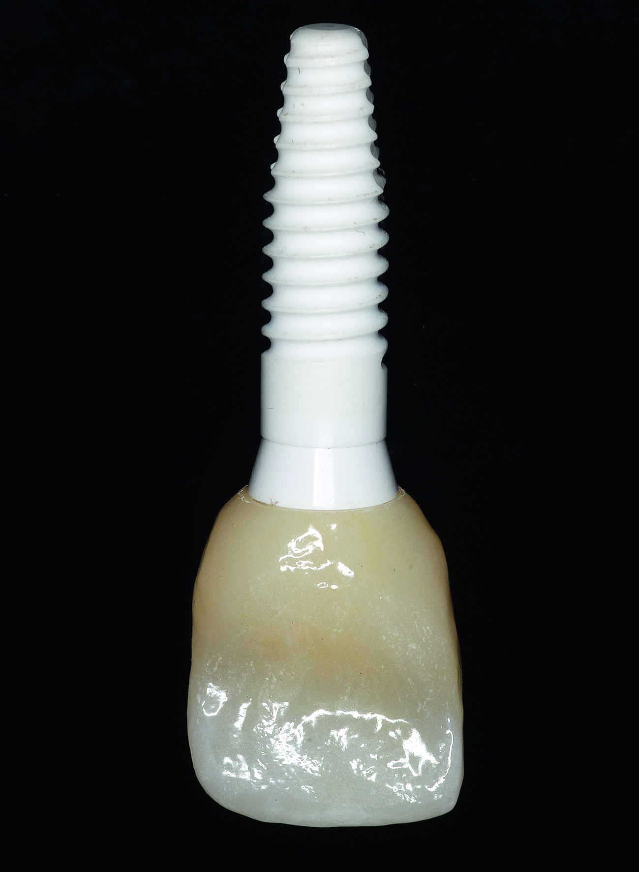Dental News - Single-tooth restoration using an all-ceramic implant ...