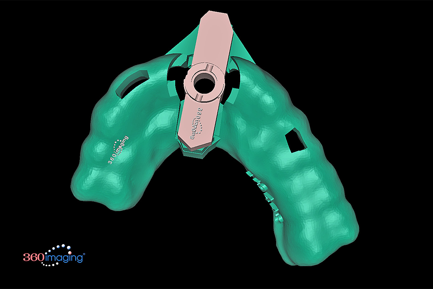 Dental News - Guided applications for partial extraction therapy