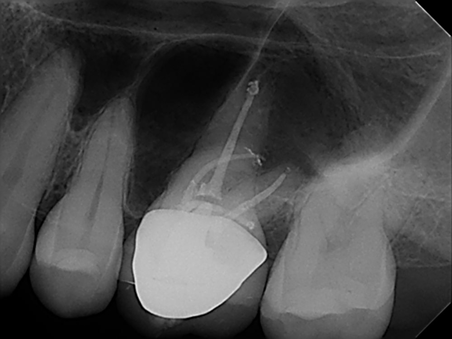 Dental News - EdgeFile X7: Beastly bifurcation