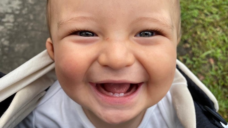 Fallece Carl Misch, pionero de la implantología oral