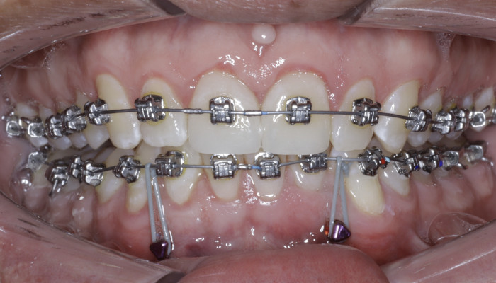 DT News - International - New Age orthodontics and orthopaedics with ...