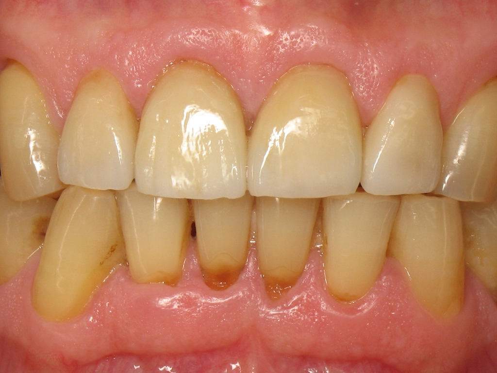 Dental News - Tenet : Time inversion applied to dentistry