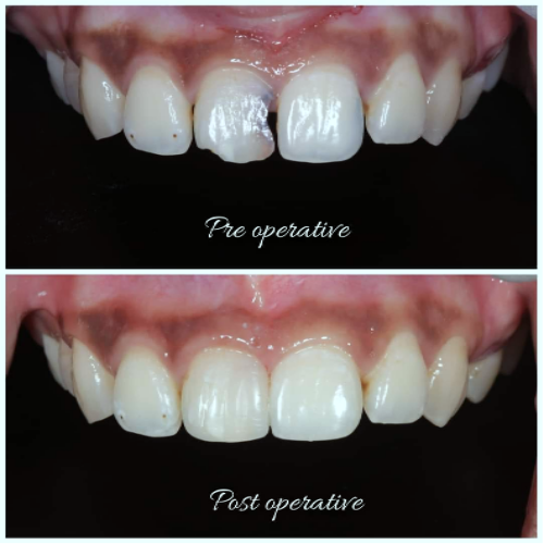 DT News - India - Interview: "Denthue removes human errors of shade ...