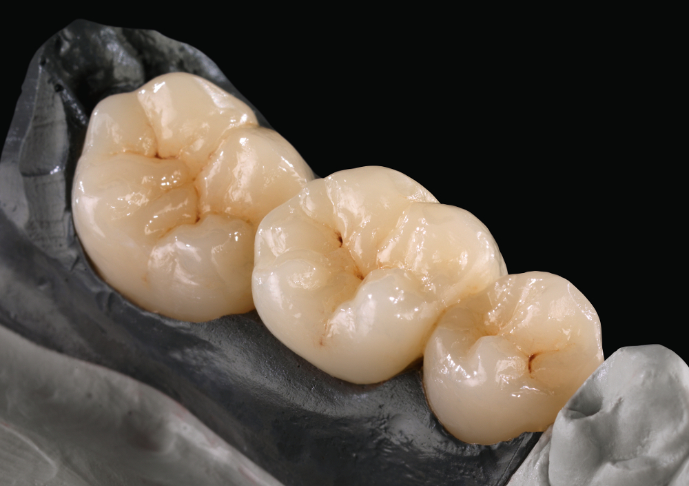 Zolid zirconia turns 10, remains as successful as ever