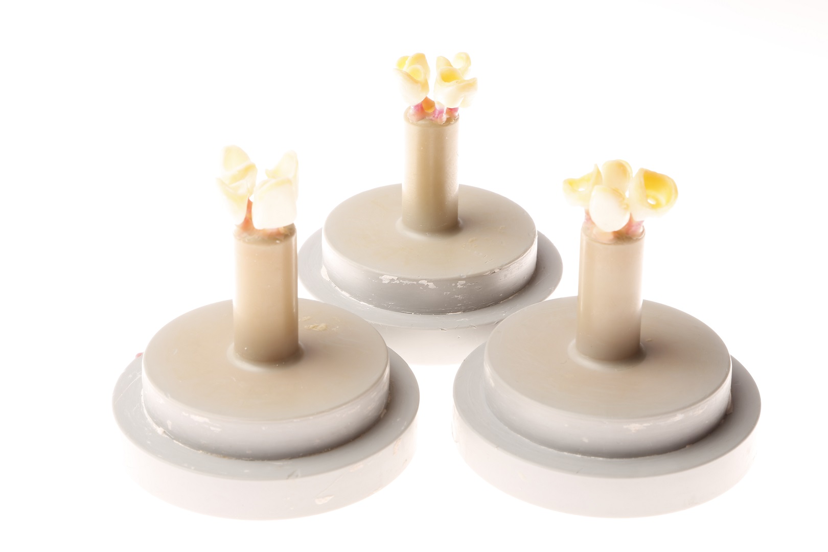 Dental News - Full-arch rehabilitation with lithium disilicate ...