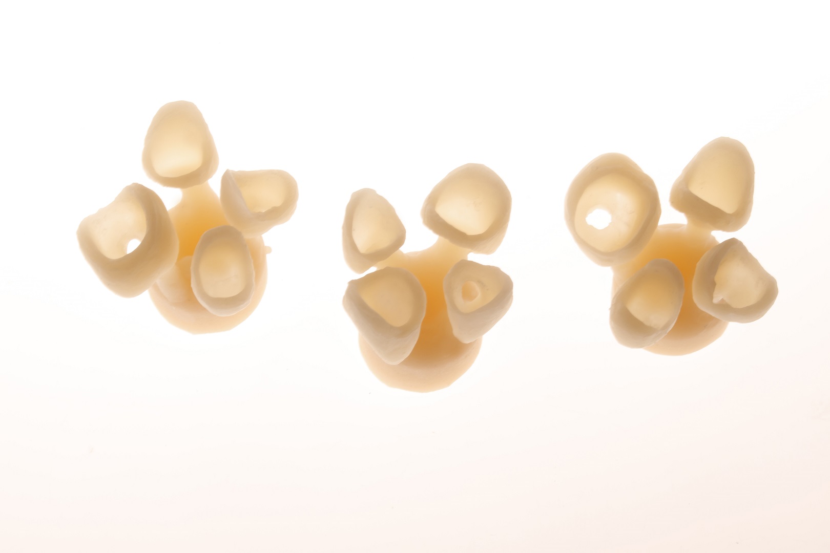 Dental News - Full-arch rehabilitation with lithium disilicate ...