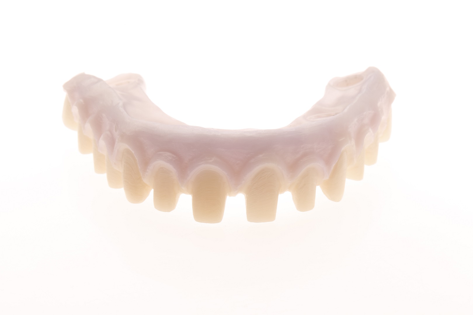 Dental News - Full-arch rehabilitation with lithium disilicate ...