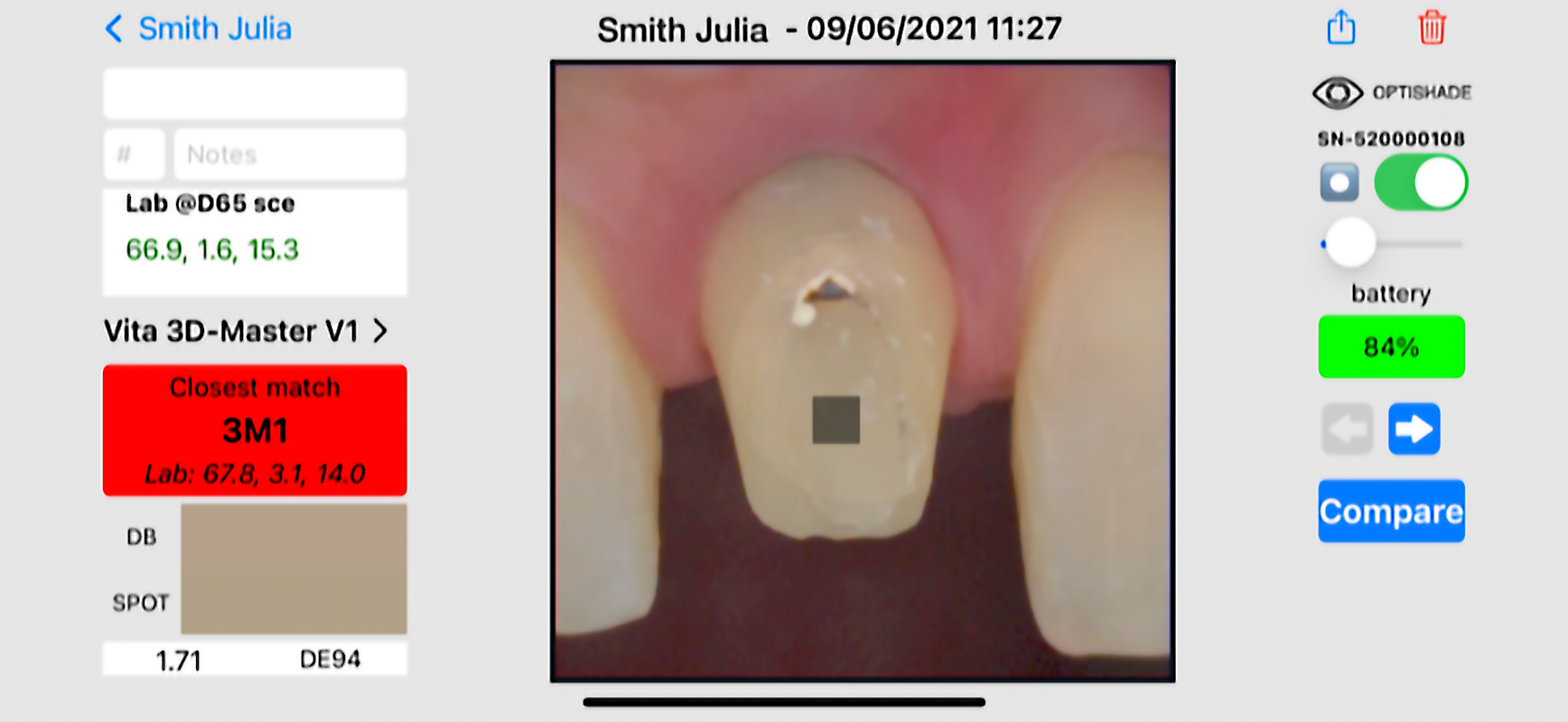 Digital dental shade measurement