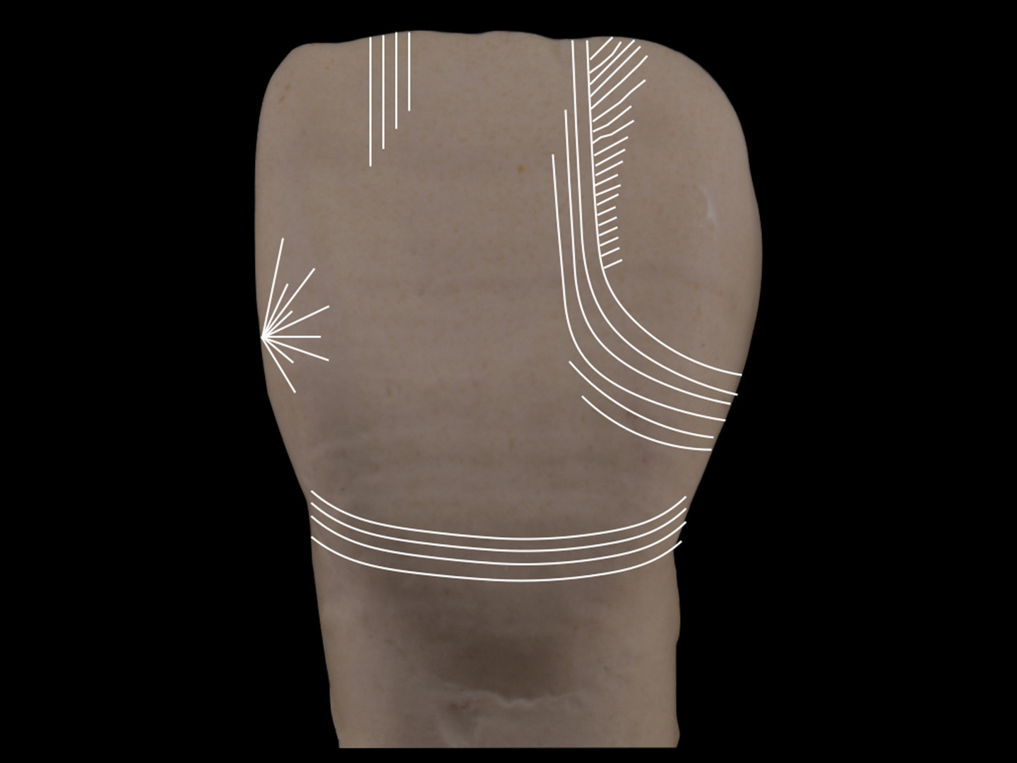 Dental News - Surface texture: Using horizontal and vertical lines to ...