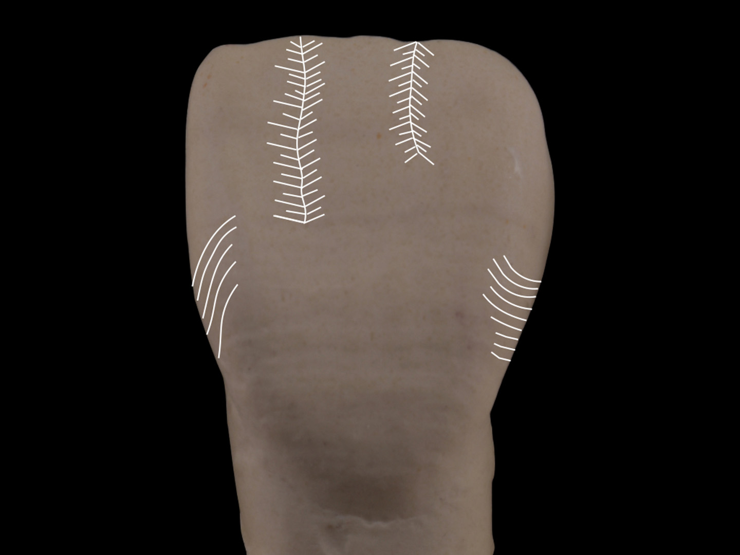 Dental News - Surface texture: Using horizontal and vertical lines to ...