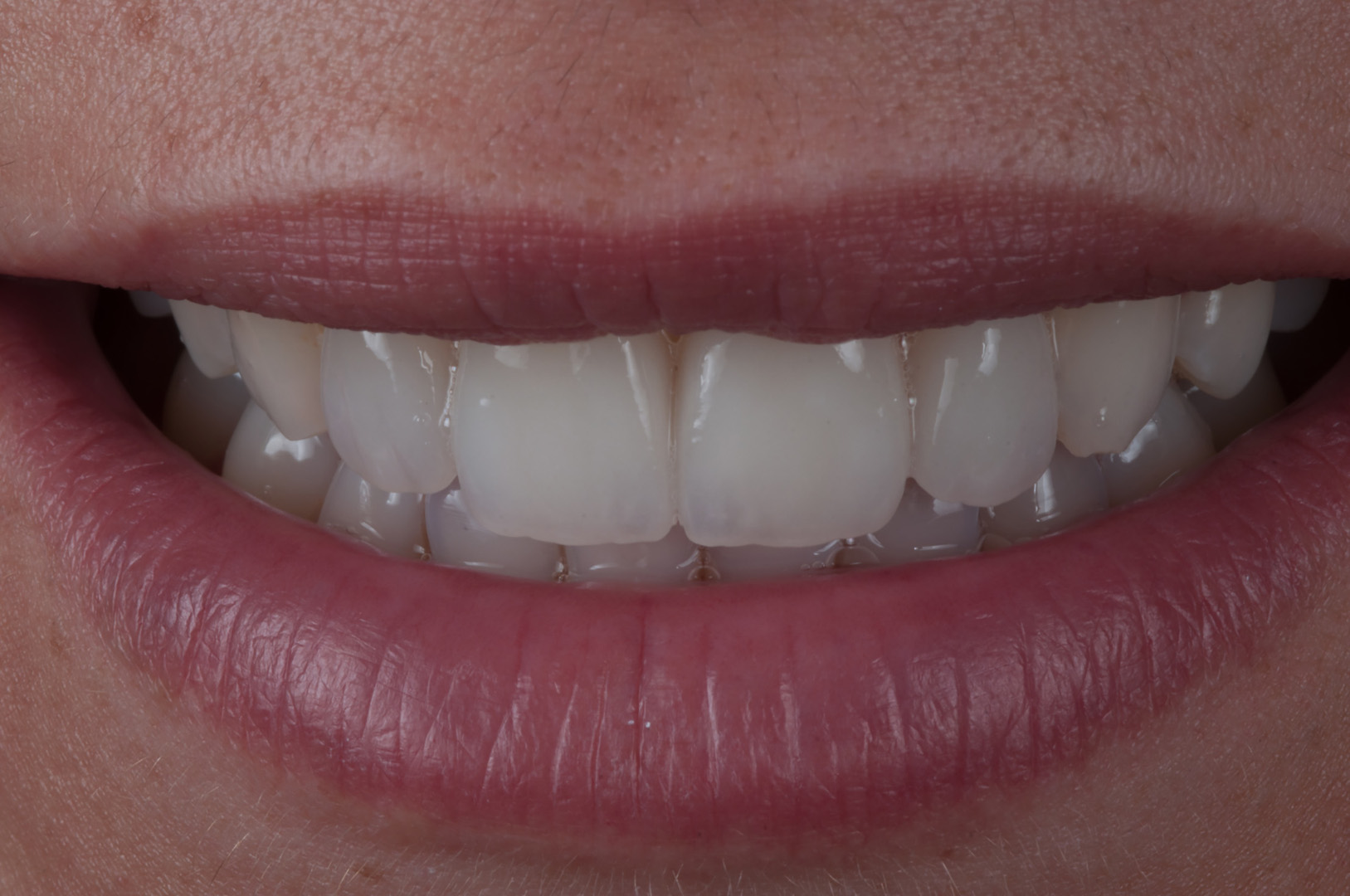 DT News - International - Surface texture: Using horizontal and ...