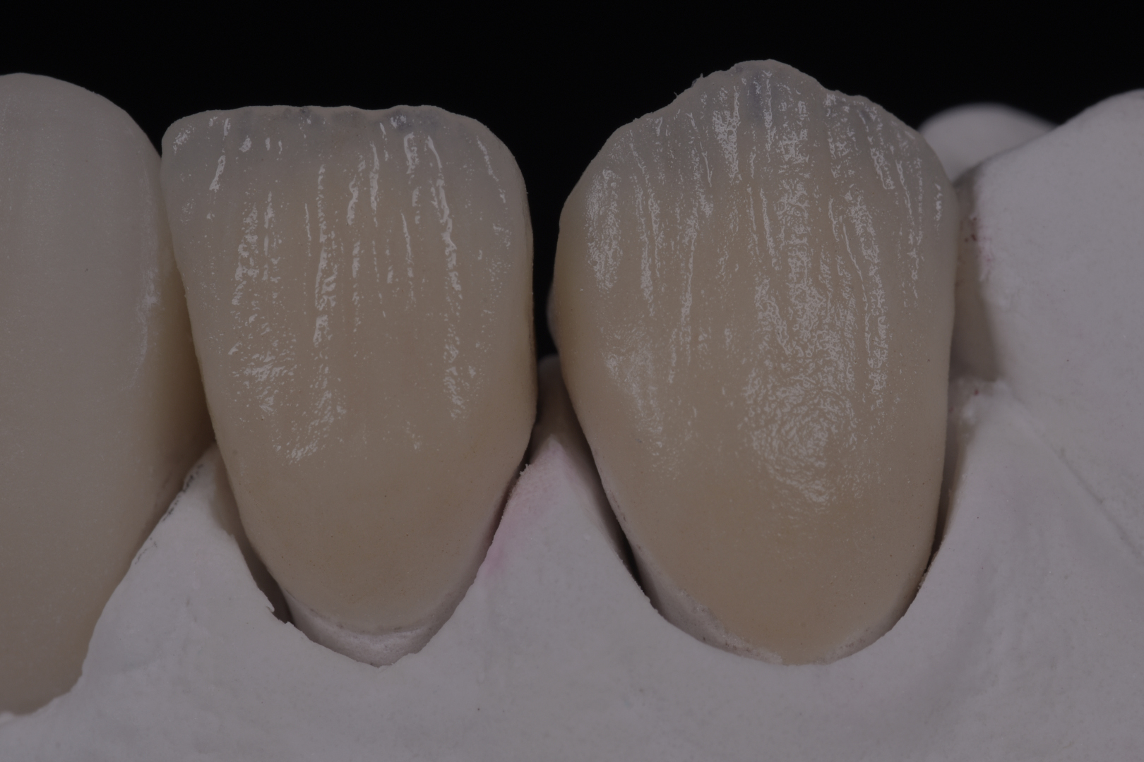 DT News - International - Surface texture: Using horizontal and ...