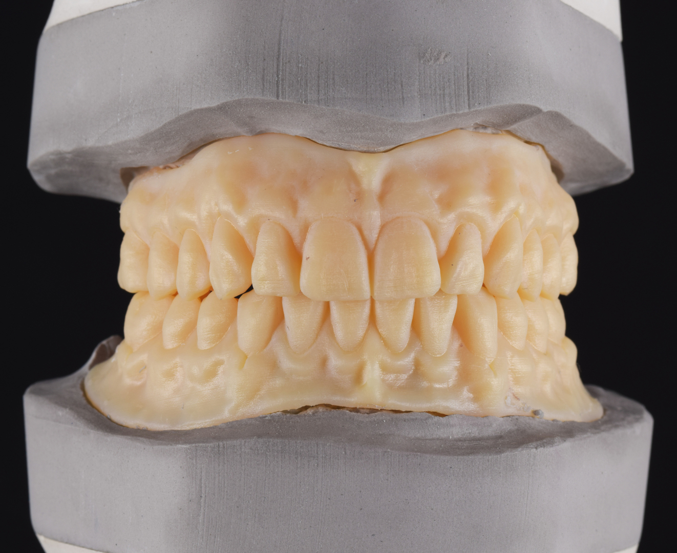 Dental News - Production of complete maxillary and mandibular dentures ...