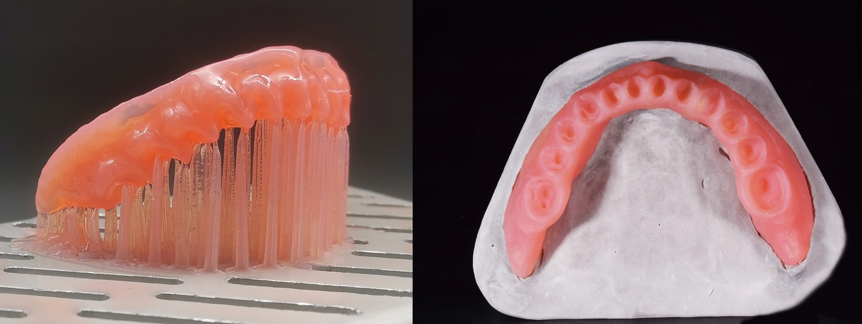 Dental News - Production of complete maxillary and mandibular dentures ...