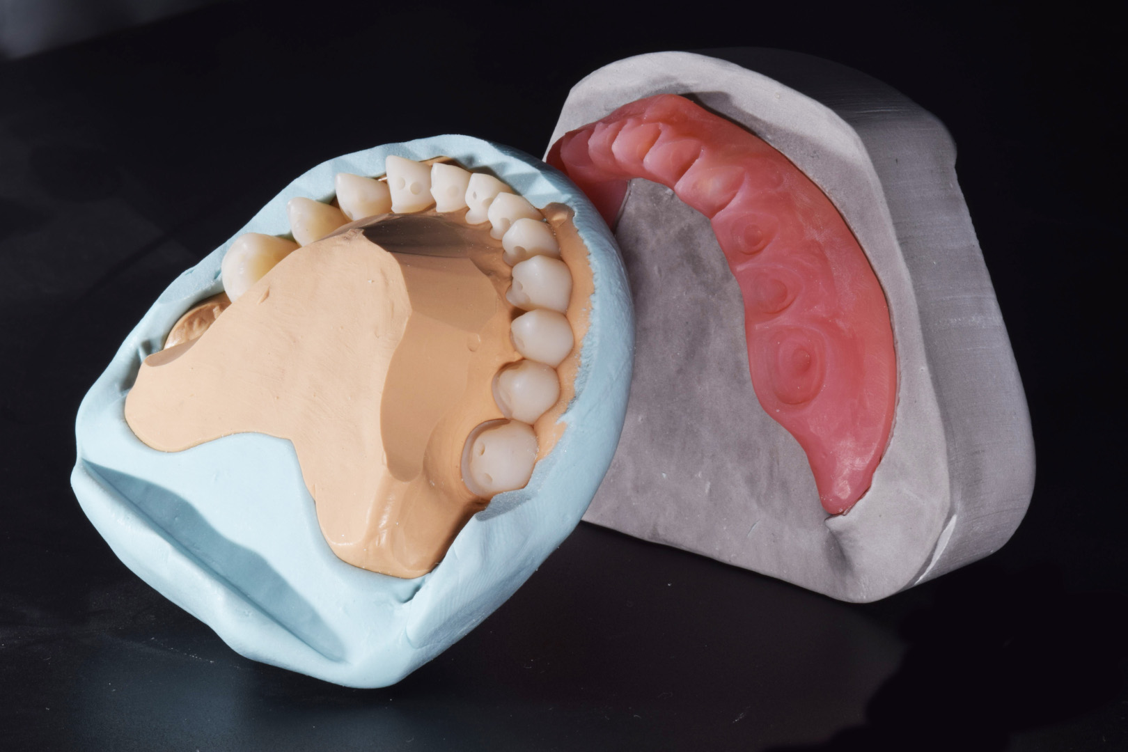 Dental News - Production of complete maxillary and mandibular dentures ...