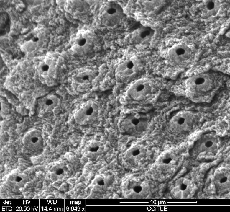 DT News - Latin America - Láser en Odontología Conservadora (8)