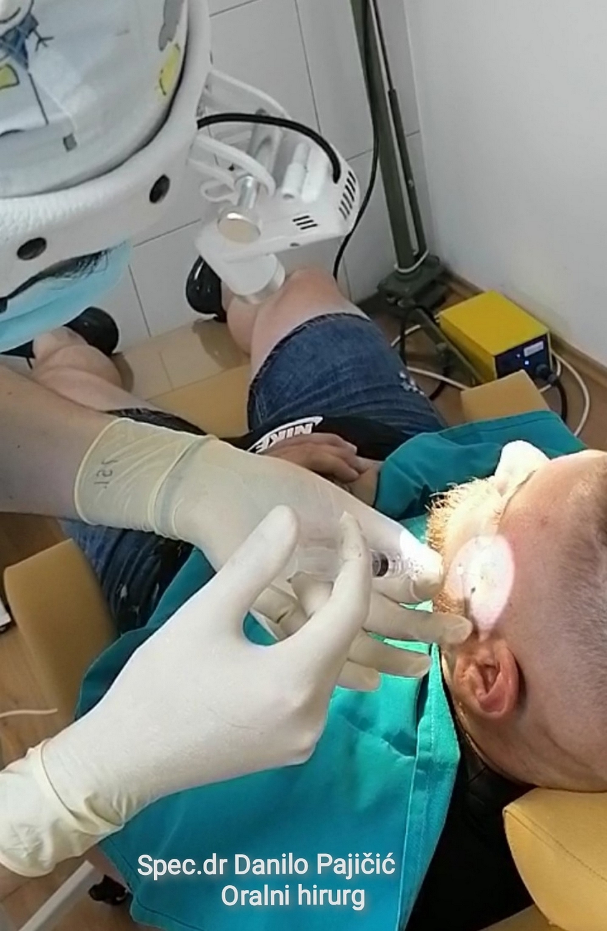 DT News - Serbia & Montenegro - Hirurško uklanjanje retencione ciste (mukokele) iz maksilarnog ...