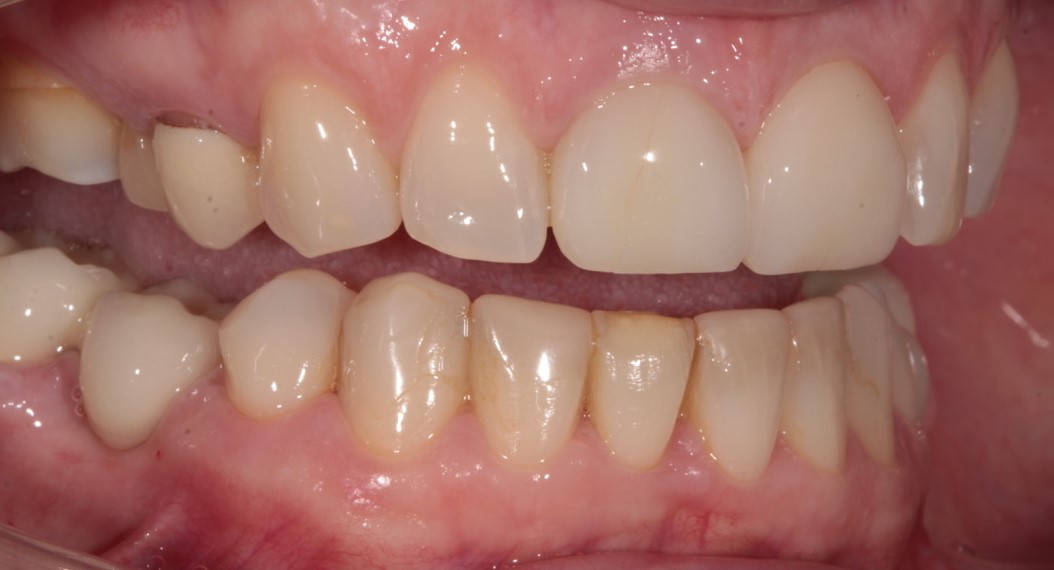 DT News - International - The informed, lifetime patient