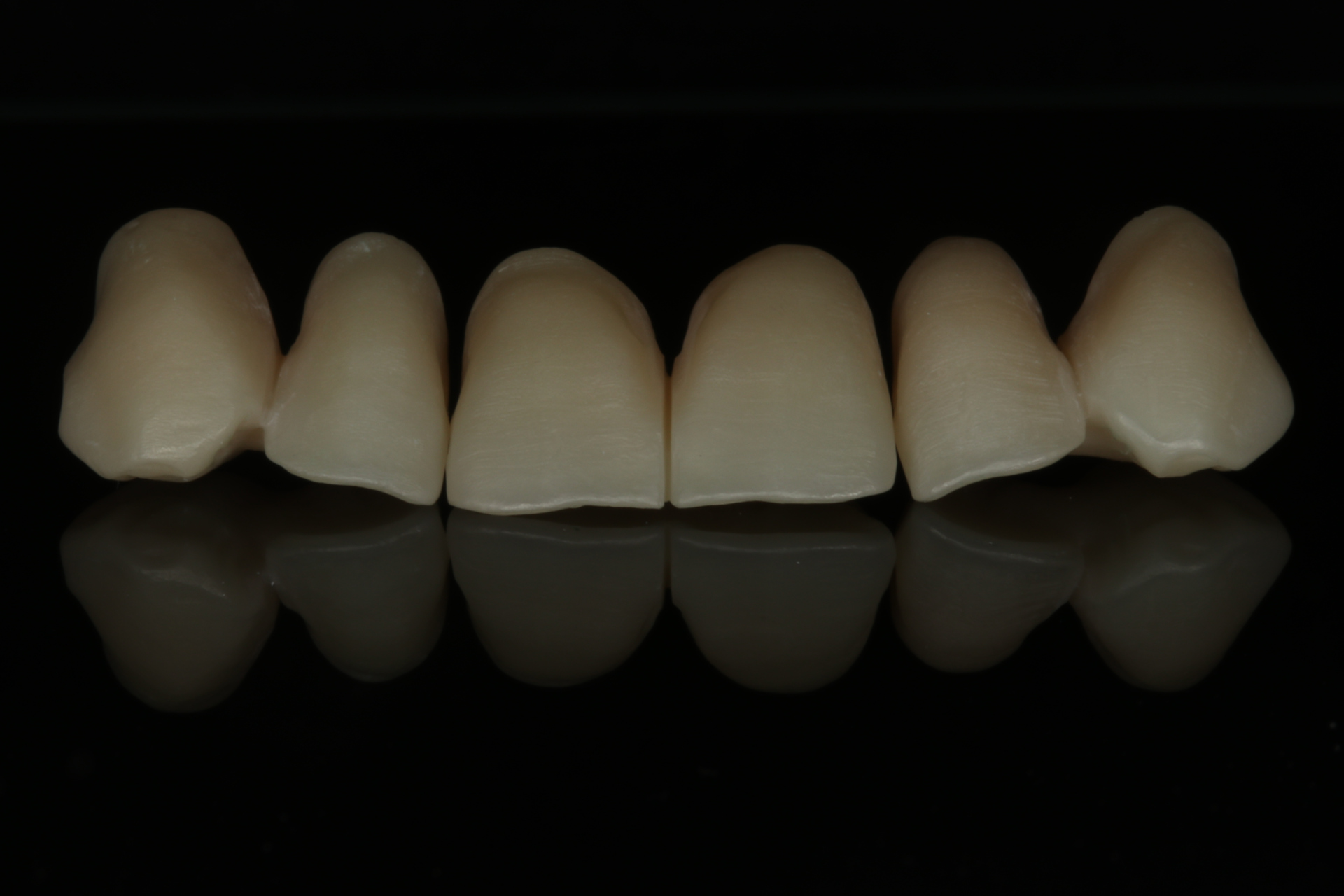 The zirconia dream team: Effect liquids and micro-layering