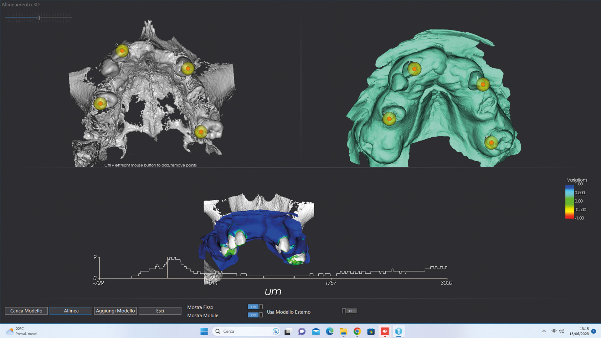 DT News - Italy - Riabilitazione full-arch a carico immediato guidato ...