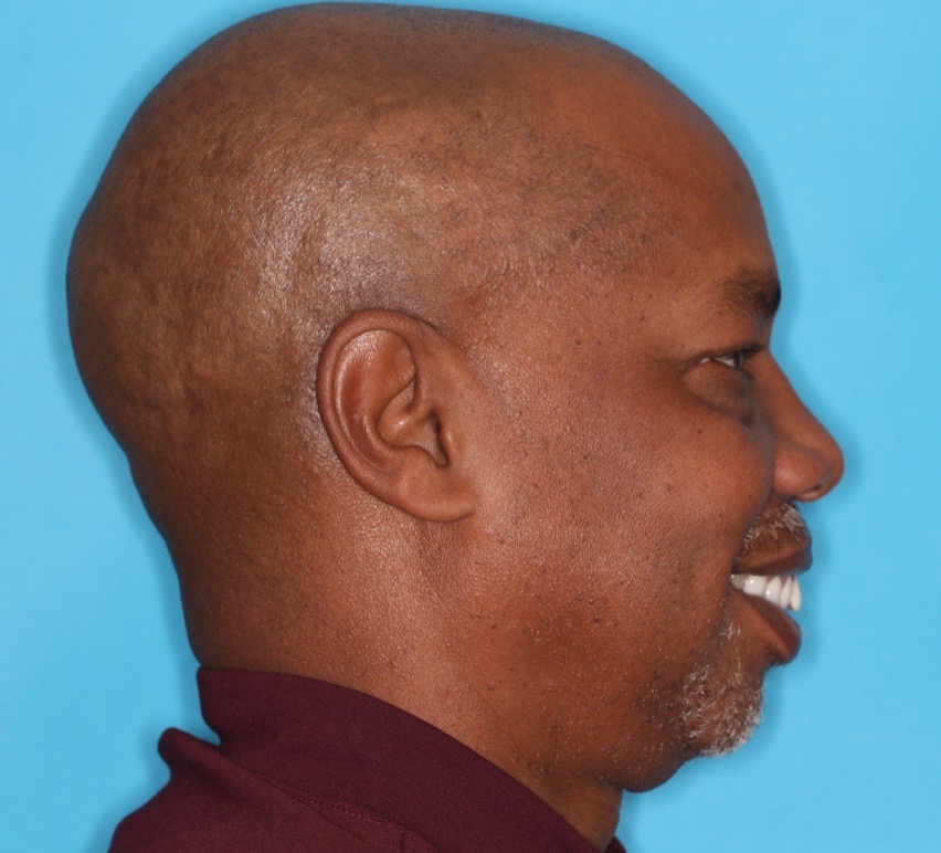 Predictable aesthetic success with a digital workflow