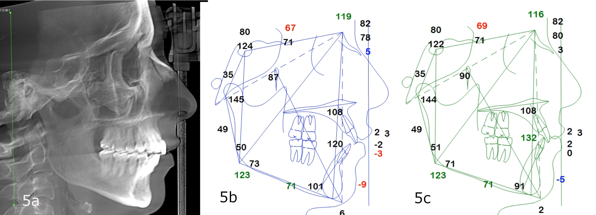 The FAS Aligner System