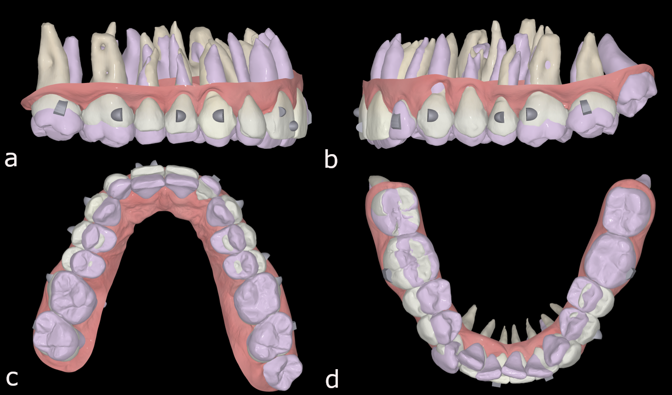 The FAS Aligner System