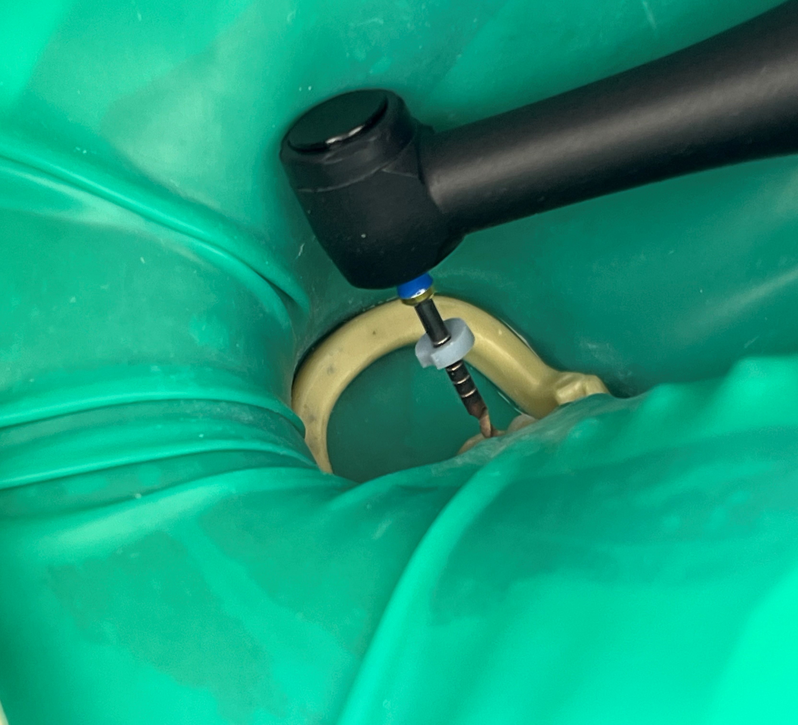 Practical tips for reliable endodontic treatment