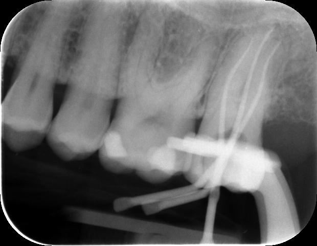 Practical tips for reliable endodontic treatment