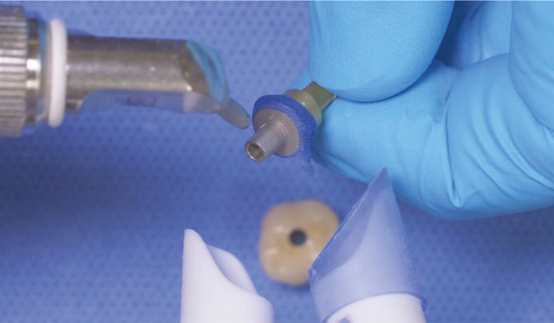 Titanium base implant cementation technique